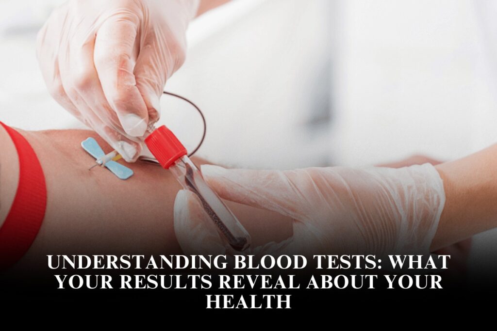 Understanding Blood Tests: What Your Results Reveal About Your Health ...